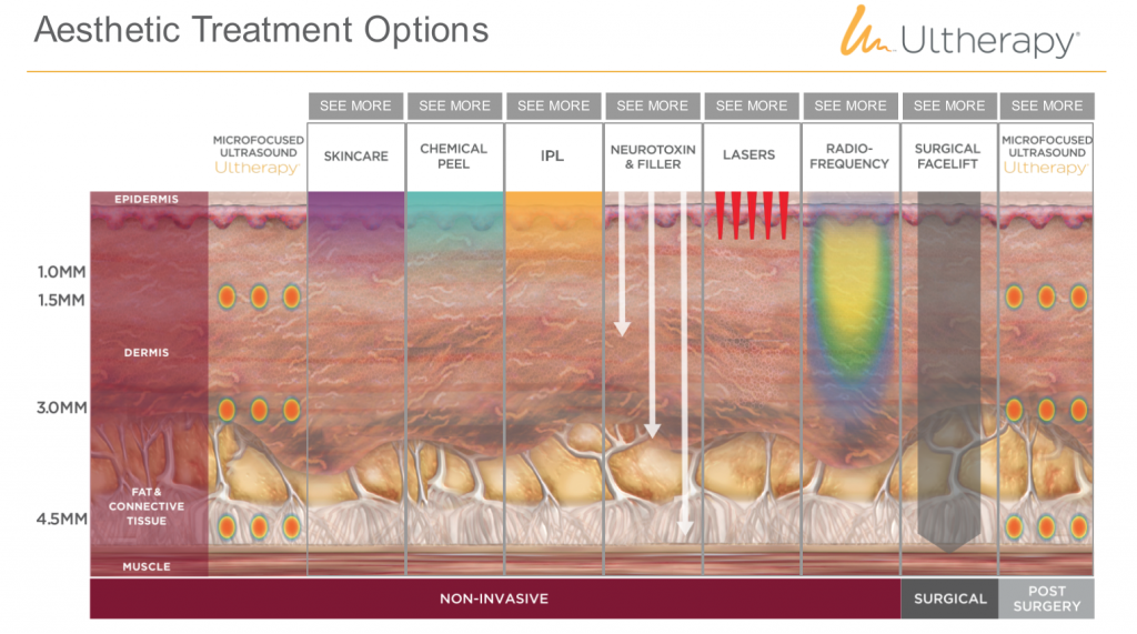 Ultherapy | Skin House Laser Clinic